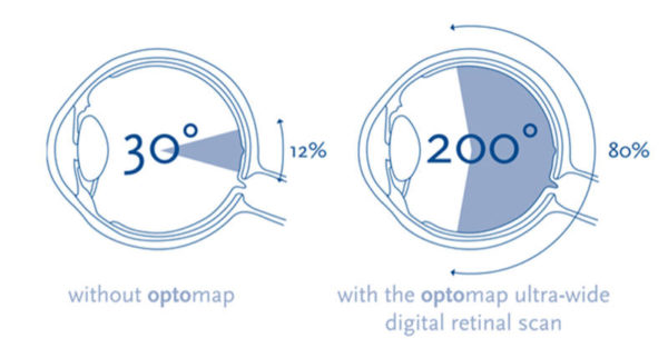 Optomap Ultra-Widefield Retinal Imaging – Gardiner Opticians