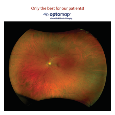 Optomap Ultra-Widefield Retinal Imaging – Gardiner Opticians